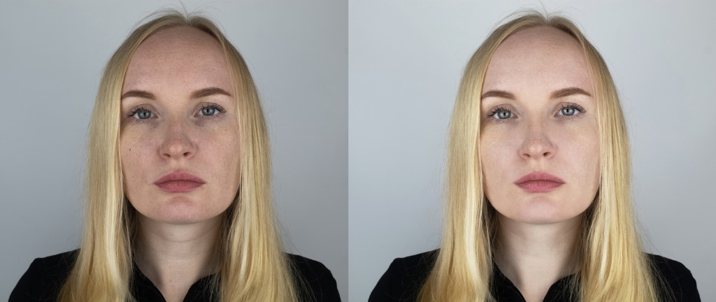 Skin Minimalism - Vedas Medical Spa & Wellness | Aesthetic | Cosmetic ...